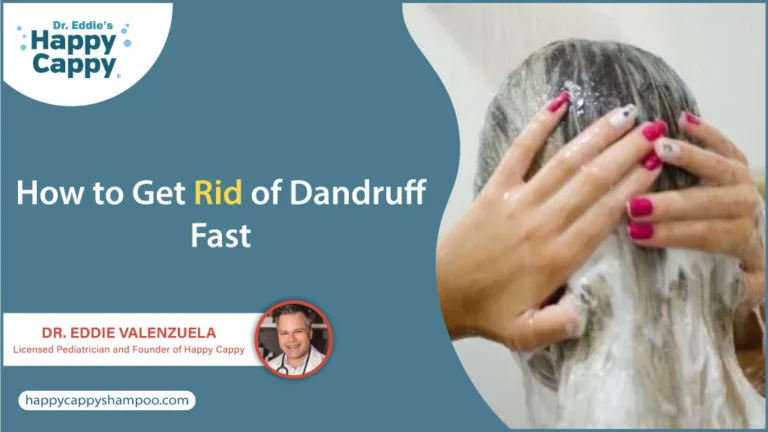How to Get Rid of Dandruff Fast: 8 Effective Ways - Happy Cappy