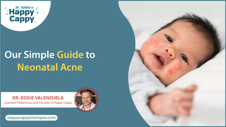 Our Simple Guide to Neonatal Acne - Happy Cappy
