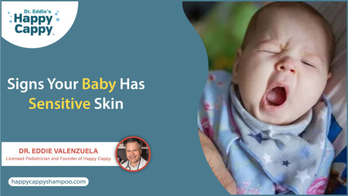 7 Signs Your Baby Has Sensitive Skin - Happy Cappy