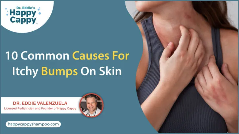 10 Common Causes For Itchy Bumps On Skin - Dr. Eddie's Happy Cappy