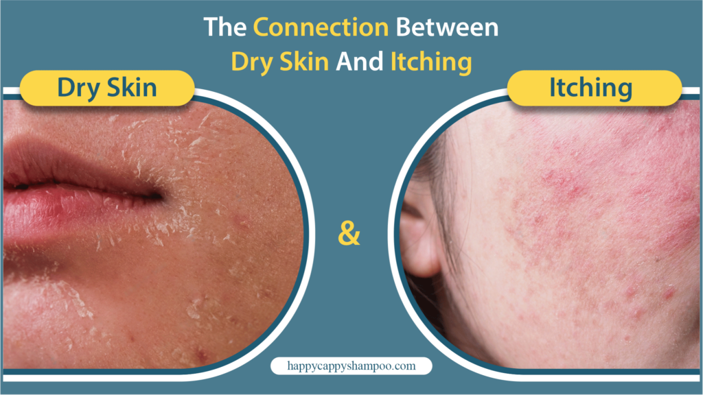 The Connection Between Dry Skin and Itching - Dr. Eddie's Happy Cappy