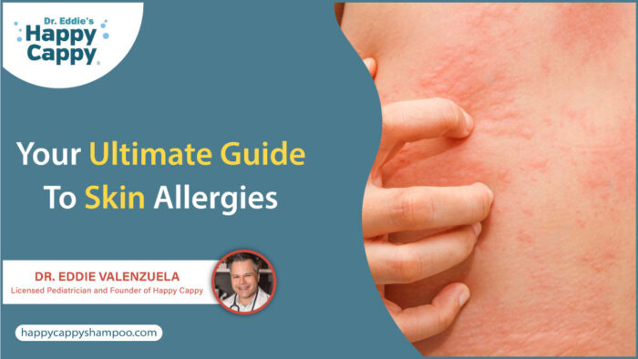Your Ultimate Guide To Skin Allergies - Dr. Eddie's Happy Cappy