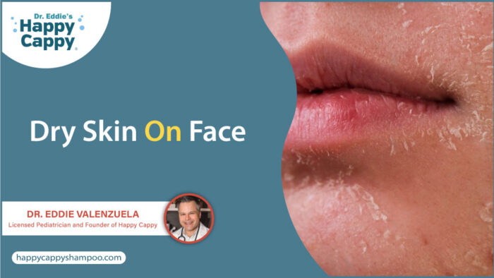 Dry Skin On Face: 9 ways to get rid of dry skin - Dr. Eddie's Happy Cappy