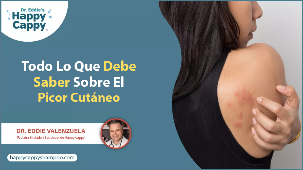 Todo lo que debe saber sobre la erupción cutánea con picor