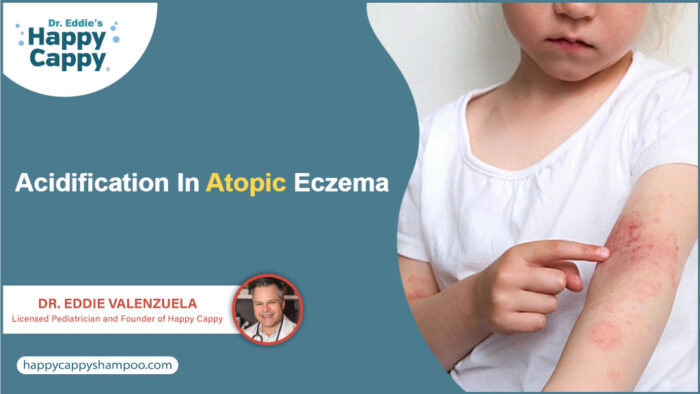 Acidification In Atopic Dermatitis - Dr. Eddie's Happy Cappy
