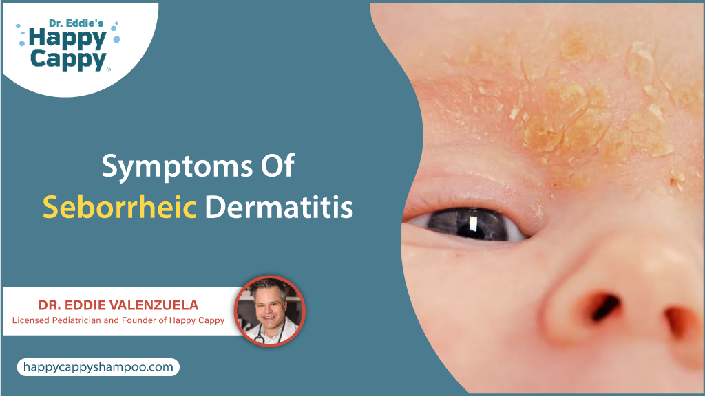Infant Seborrheic Dermatitis Scalp Treatment Symptoms And Seborrheic