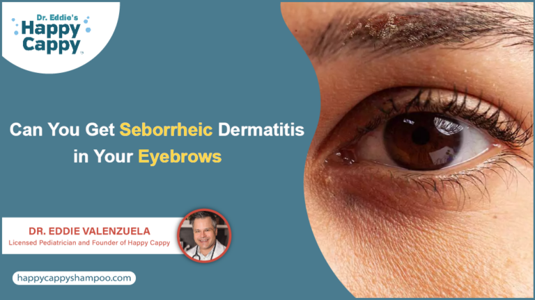 Can You Get Dandruff (Seborrheic Dermatitis) in Your Eyebrows