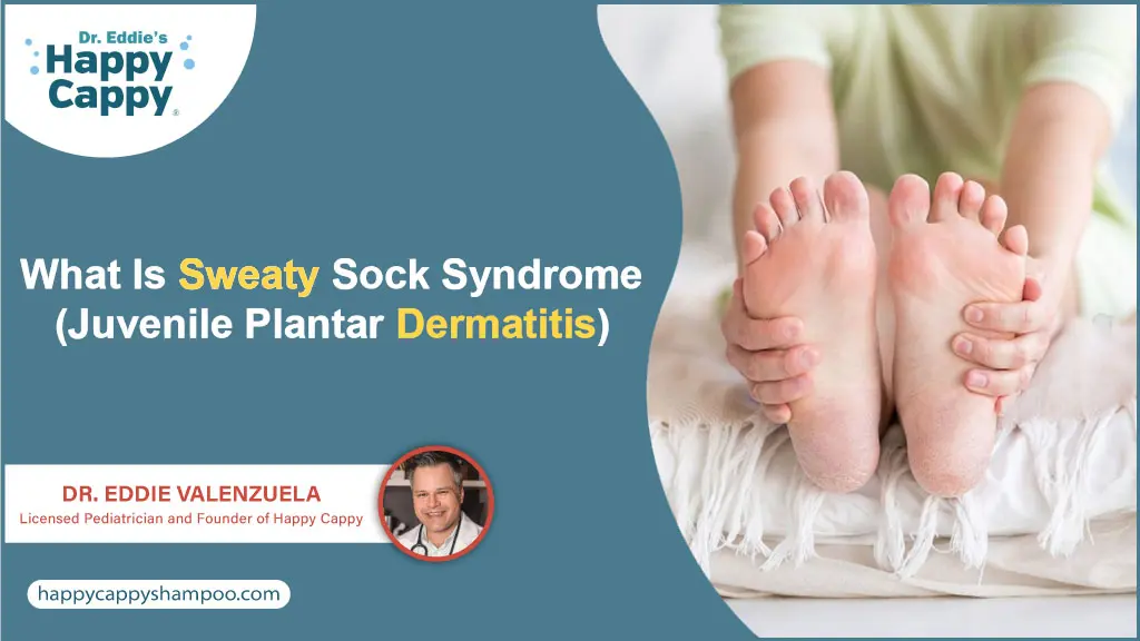 What Is Sweaty Sock Syndrome (Juvenile Plantar Dermatosis)