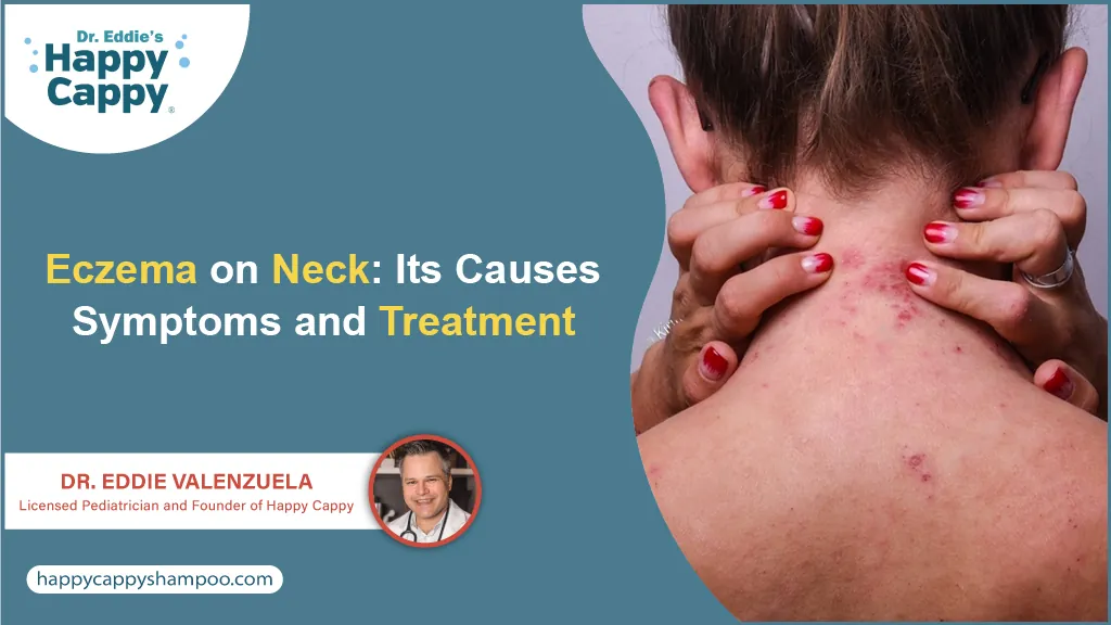 Eczema On Neck Its Causes Symptoms And Treatment Happy Cappy