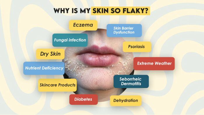 Why is My Skin Flaky, and How Do I Get Rid of It? - Happy Cappy