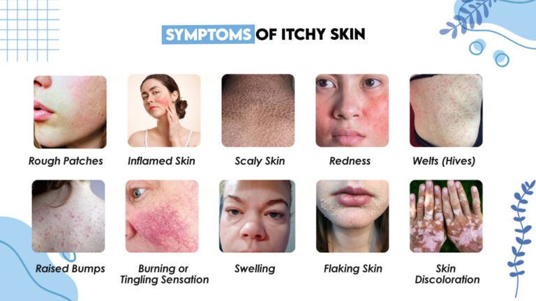 Guide to itchy skin - Dr. Eddie's Happy Cappy
