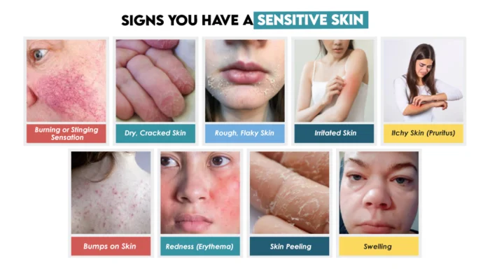 What Causes Sensitive Skin and How to Treat It?