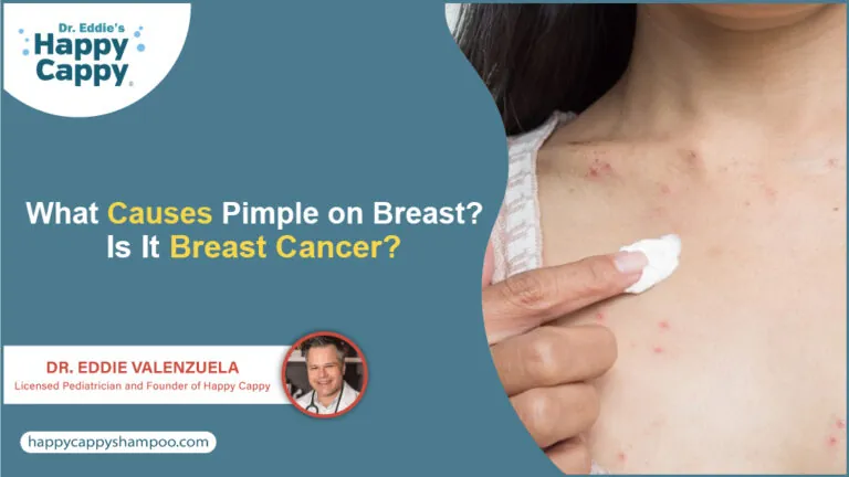 What Causes Pimple on Breast? Is It Breast Cancer? - Happy Cappy