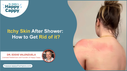 Itchy Skin After Shower: How to Get Rid of it? - Happy Cappy