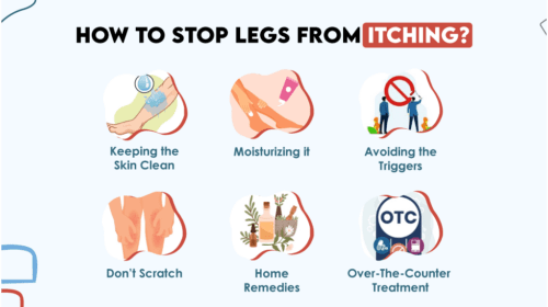 Why Are My Legs Really Itchy? 11 Common Causes - Happy Cappy