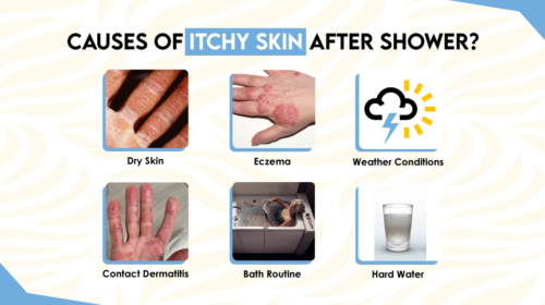 Itchy Skin After Shower: How to Get Rid of it? - Happy Cappy