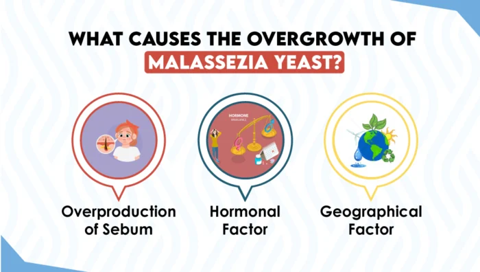 Malassezia Yeast and the Skin Conditions It Can Cause - Happy Cappy