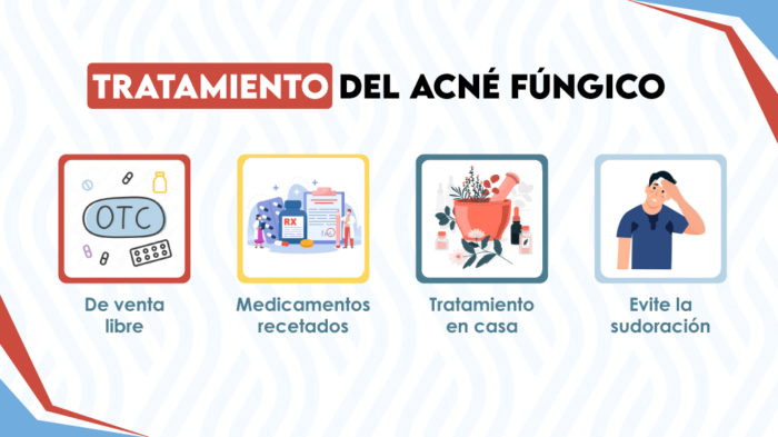 Tratamiento del acné fúngico: una guía sencilla - Happy Cappy